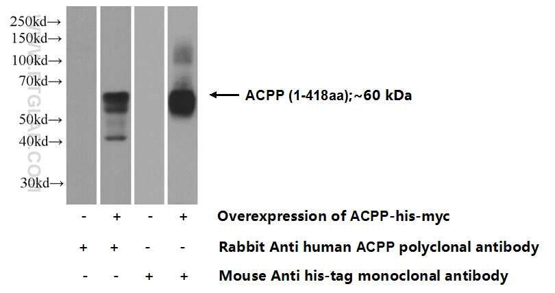 ACPP Fusion Protein Ag8592 | Proteintech | 武汉三鹰生物技术有限公司