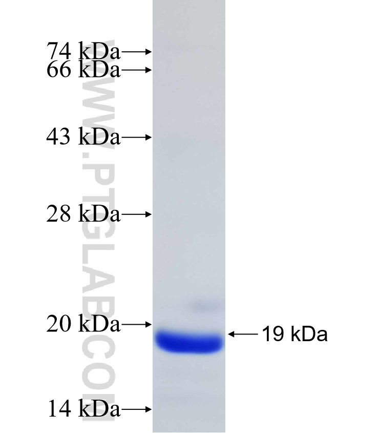 apcB Fusion Protein Ag31852 | Proteintech | 武汉三鹰生物技术有限公司