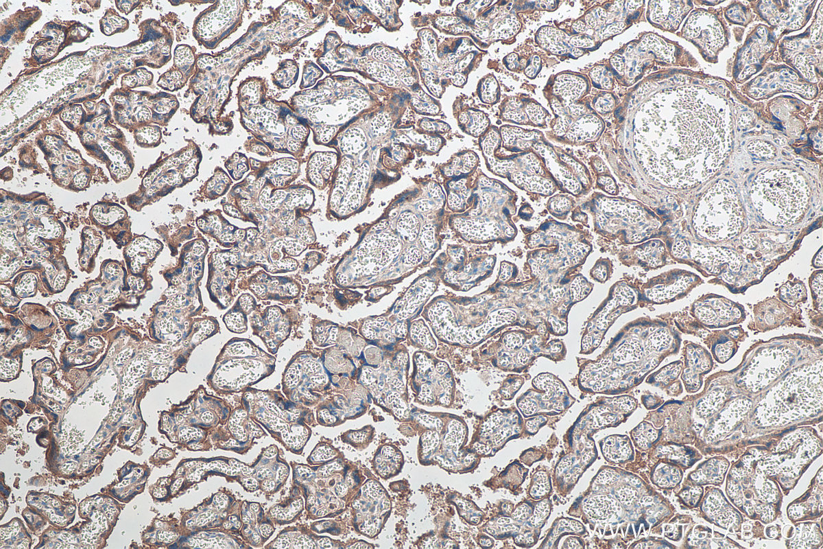 nectin 4 Fusion Protein Ag14414 | Proteintech | 武汉三鹰生物技术有限公司