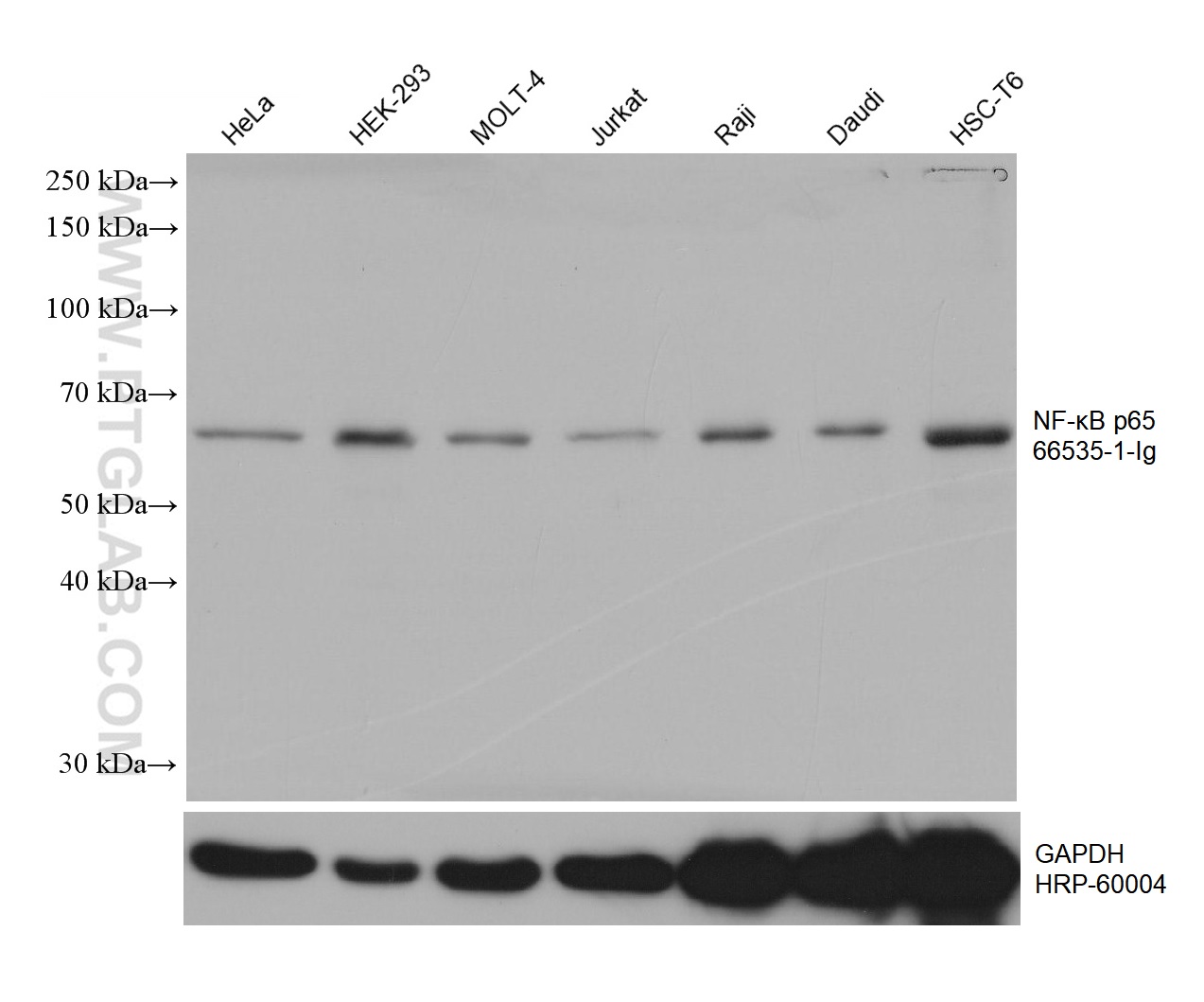 NF-κB p65 antibody (66535-1-Ig) | Proteintech | 武汉三鹰生物技术有限公司