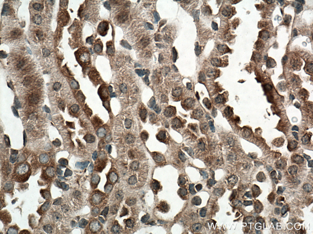 NF-κB p65 Antibody 10745-1-AP | Proteintech