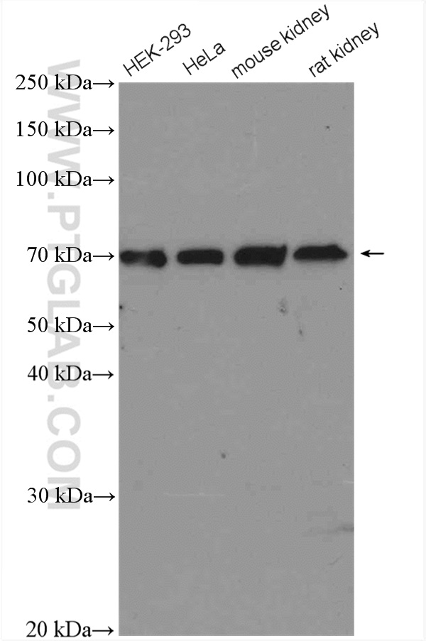 NF-κB p65 Antibody 10745-1-AP | Proteintech