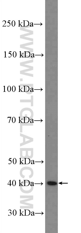 SLC7A11/xCT antibody (26864-1-AP) | Proteintech | 武汉三鹰生物技术有限公司